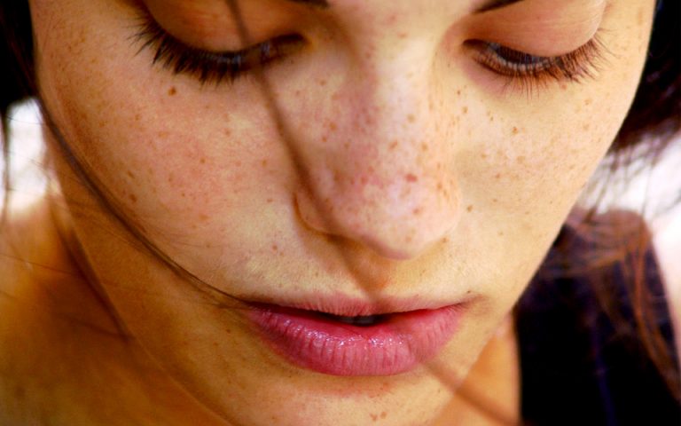 Dull skin/Pimples – All About Eve